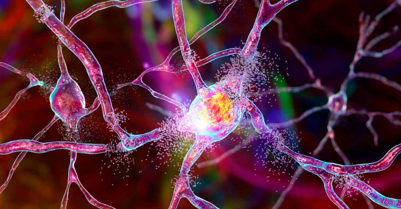 Parkinson y enfermedades Neurodegenerativas – Neurocell